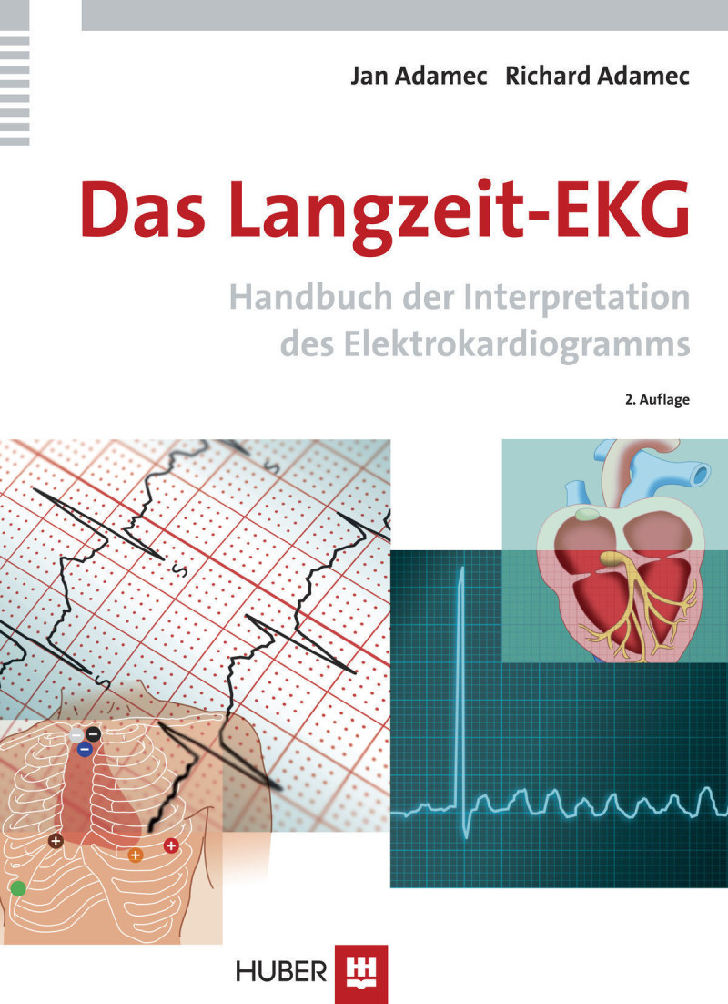 Das Langzeit-EKG - 2009 - Handbuch der Interpretation des Elektrokardiogramms | Hogrefe